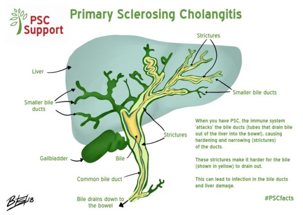 Overview Of PSC – PSC Support