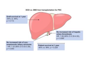 Liver Transplantation – PSC Support