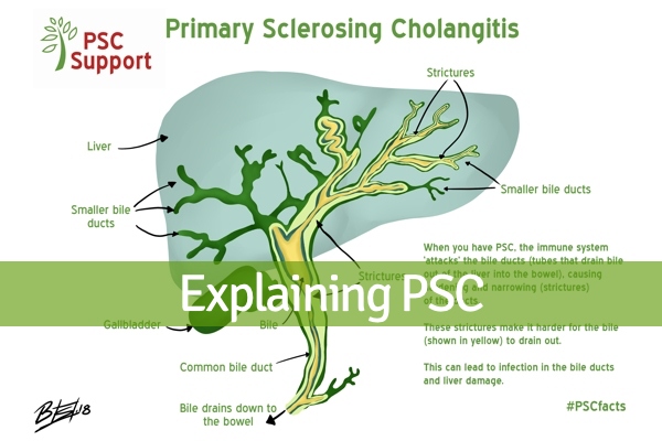 All About PSC - PSC Support